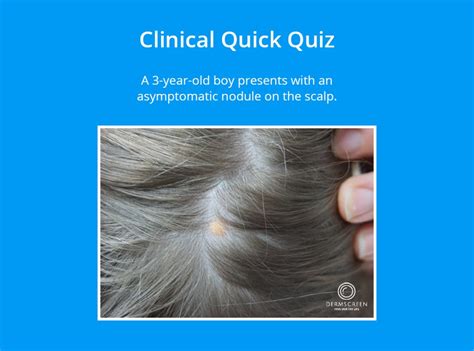 Clinical Quick Quiz What Is The Most Appropriate Diagnosis For This