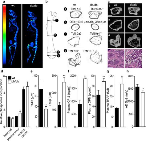 Bone Phenotype Of The Leptin Receptor Deficient Dbdb Mouse A