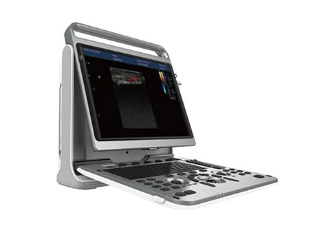 Msk Portable Ultrasound Scanner Machine With 18 Mhz High Frequency Linear Probe Ultrasound