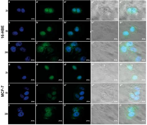 Gadolinium Doped Carbon Nanodots As Potential Anticancer Tools For Multimodal Image Guided