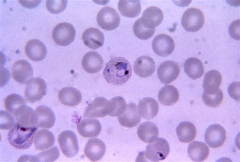 Public Domain Picture This Thin Film Giemsa Stained Micrograph