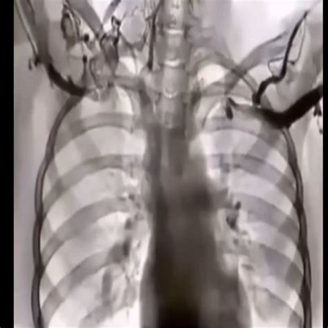 Stream Why Are U Crying Vuksai By Kunai Listen Online For Free On