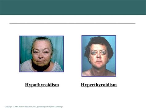 Thyroid Hormone Synthesis Ppt