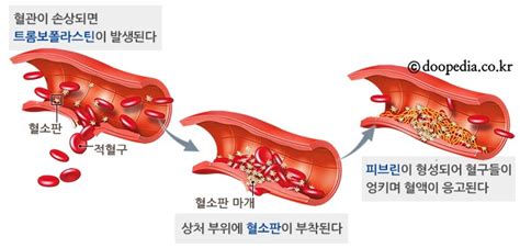혈액의 구성과 혈액응고에 대해 알아보자 혈액세포 지혈과정 네이버 블로그