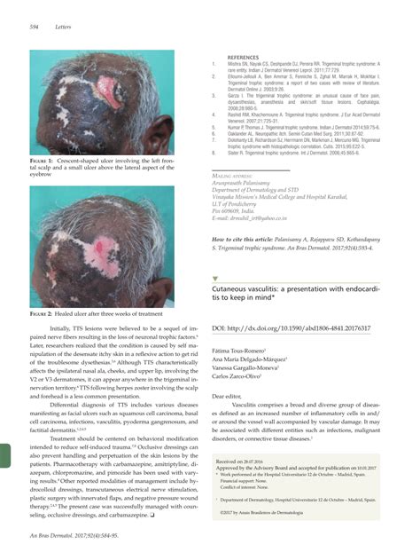 Pdf Cutaneous Vasculitis A Presentation With Endocarditis To Keep In Mind