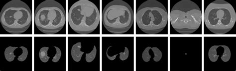 Examples Of Lung Segmentation Results Applying Our Unsupervised Download Scientific Diagram