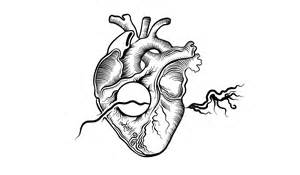 76 Year Old From Hyderabad With Multiple Complications Undergoes Heart Procedure Telangana Today