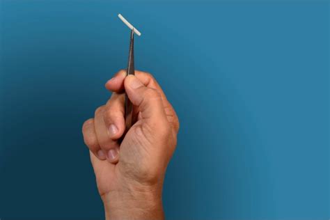 Benefícios dos implantes hormonais revolução na terapia hormonal
