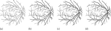 5 Vessel Filling Ac Results Of Consecutive Iterations And D Download Scientific Diagram