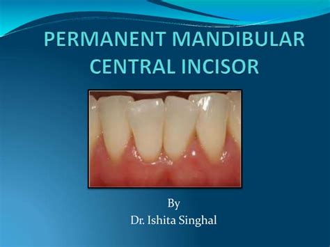 Permanant Maxillary Lateral Incisor Pptx