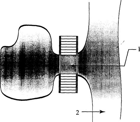 Biological Recovery Of Small Eutrophic Water Body Eureka Patsnap