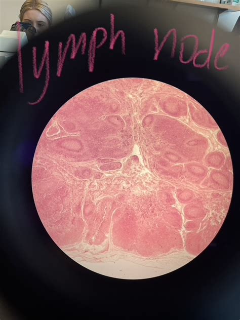 Lymph Node Diagram Quizlet Lymph Node Diagram Quizlet