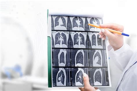Prime Live Meeting Optimizing Molecular Testing Practices To Inform