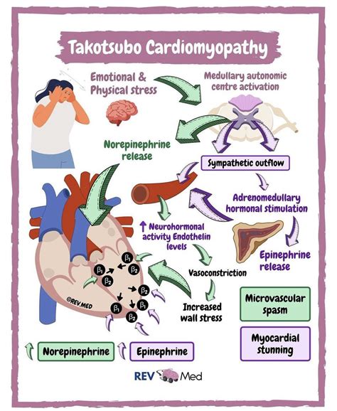 Drshrooqhawati 🇸🇦 دشروق حَـوَتي On Twitter Learn More About Broken