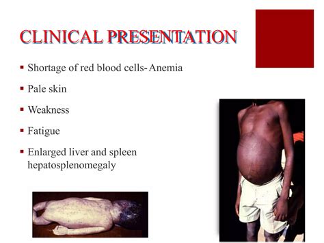 Thalassemia PPTX