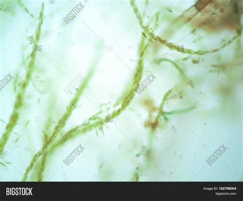 Filamentous Algae Image And Photo Free Trial Bigstock