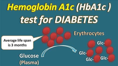 Hemoglobin A1c Test For Diabetes