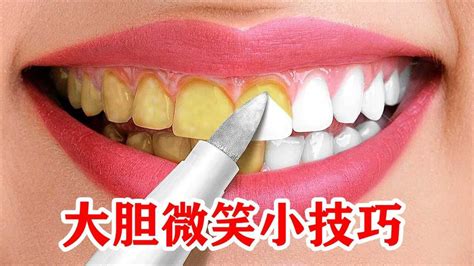 大黄牙如何才能变得洁白？几个小妙招教给你，笑得比郭碧婷还美！知识π计划 知识抢先知高清1080p在线观看平台腾讯视频