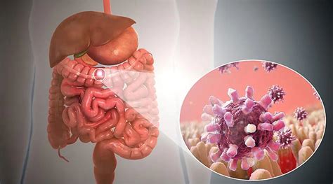 Kode Icd 10 Gea Dalam Diagnosis Gastroenteritis Akut Berita
