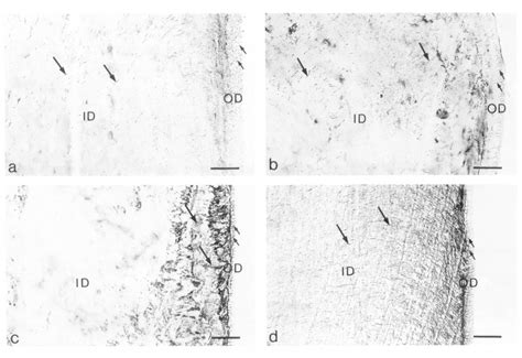 Figure 1 From Altered Collagen Expression In Human Dentin Increased
