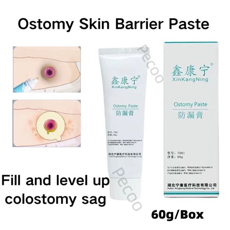 Ostomy Skin Barrier Paste Fill And Level Up Colostomy Sag To Avoid