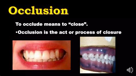 1 Occlusion In Prosthodontics Introduction Differences Between