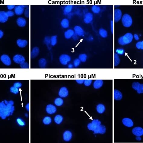 Morphological Apoptosis Of 12z Cells After Treatment With Resveratrol