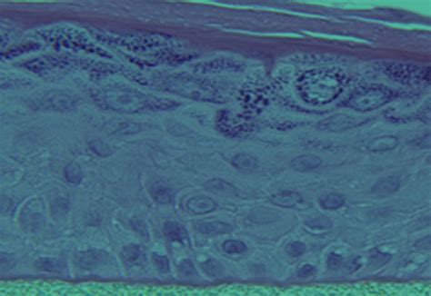 The Epiderm™ Mattek Mattek Human 3d Tissue 인공피부 주다일과학교역