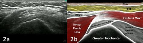 The Utilization Of Diagnostic Musculoskeletal Ultrasound In The