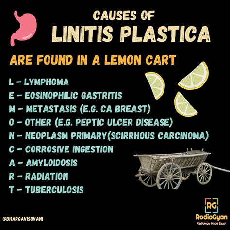 Causes Of Linitis Plastica Visual Mnemonics