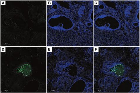 Tunel Staining Affirmed The Apoptosis Of Granulosa Cells In Both Normal