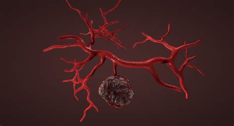 Tumor Vessel C4d