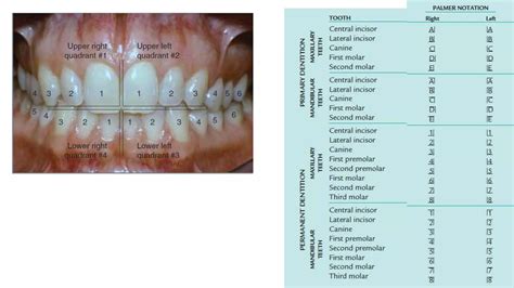 Tooth Notation Ppt
