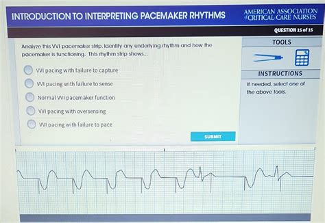 solved analyze this vvi pacemaker strip identify any