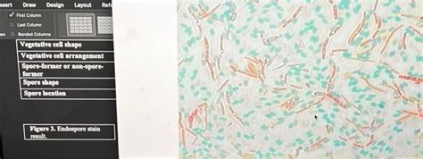 Solved Please List Endospore Vegetative Cell Shape