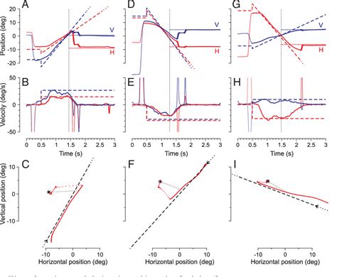 Figure 2 From Processing Of Retinal And Extraretinal Signals For Memory