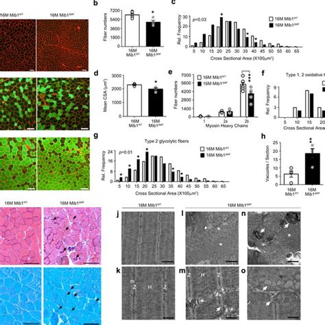 Selective Alteration Of Type 2 Glycolytic Myofiber And Abnormal