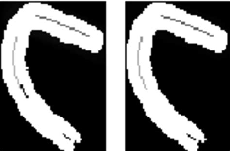 Aline Segments Obtained After Grouping Process Bthe Simplified