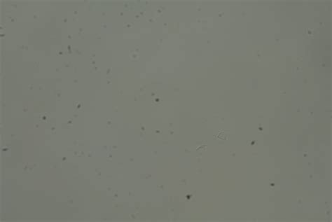 相衬与明场成像对比 口腔细胞 荧光切片 相衬 Ph 显微镜 正势利