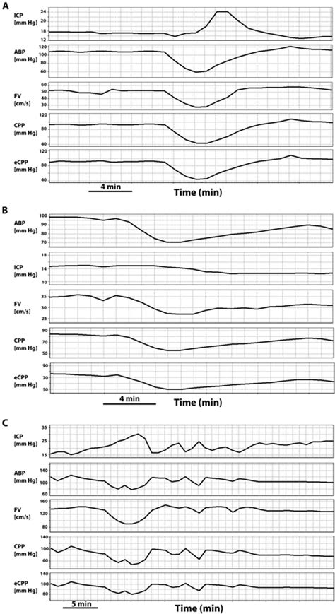 Examples Of How Cpp Was Approximated By Ecpp In Various Cpp Affecting Download Scientific