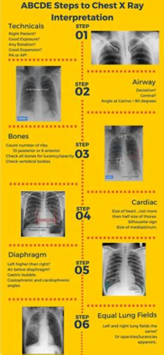 Week 1 Plain Film Radiography Flashcards Quizlet