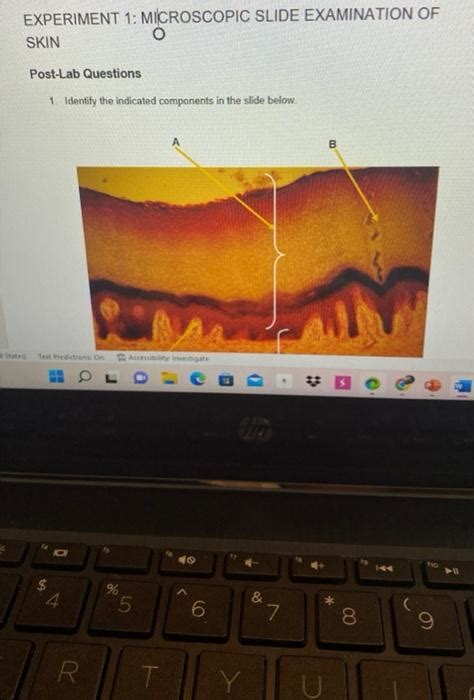 Solved Experiment 1 Microscopic Slide Examination Of Skin