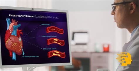 Looking To Simplify Complex Medical Concepts For Your Audience Omni Tech Medical