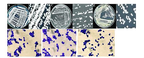 Colony And Cell Morphologies Of Ethanol Tolerant Non Saccharomyces