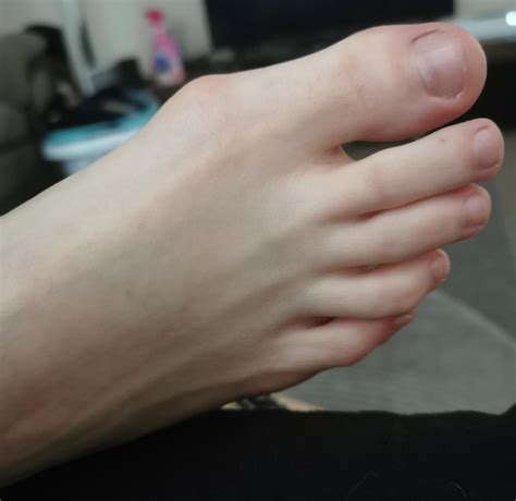 Look At My Toes 🙊 R Feetishh