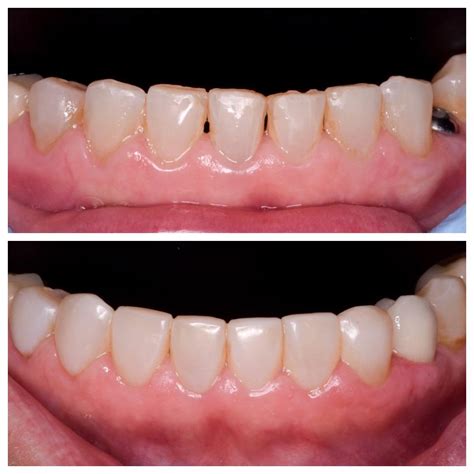 Bioclear Simi Valley Ca Simi Hills Dental