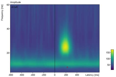 Besa® Brain Electrical Source Analysis Besa Connectivity Features