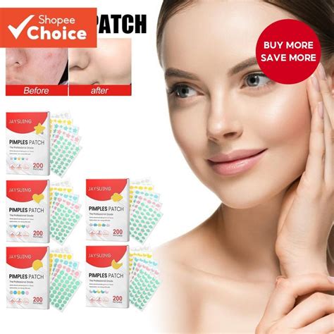 200pcs Acne Patch 5 Colors Different Shapes Patch For Acne Blackheads And Pimples
