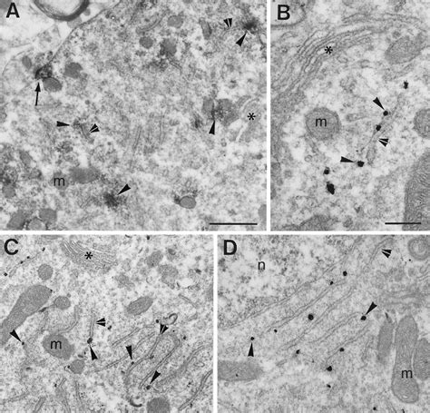 Subcellular Localization Of Glyr 1 Subunit Mrnas In The Somata Of