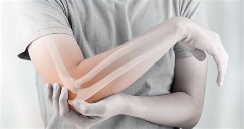 Hubungan Antara Osteoporosis Dan Gangguan Pendengaran Blog Pusat